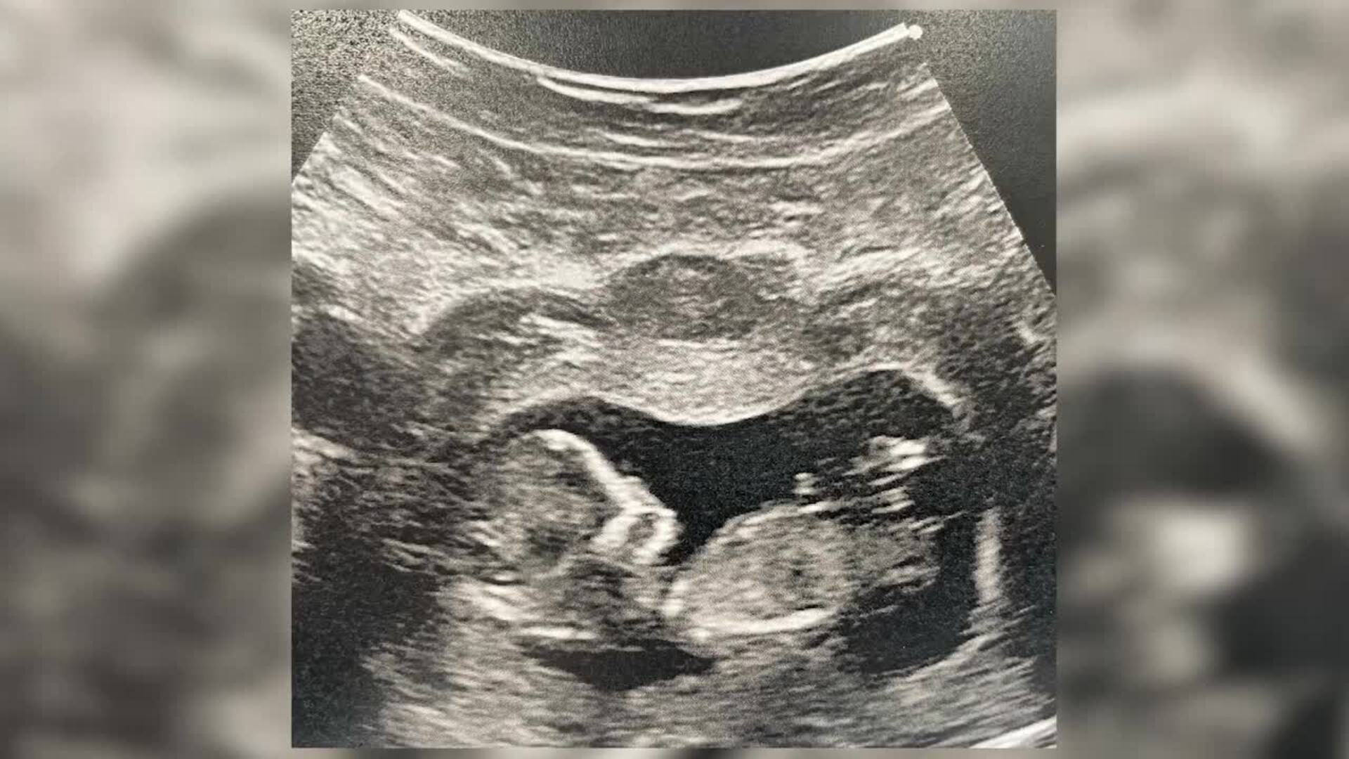 El penekini ya tiene competidor en la playa: el saco-tanga | Diario Sur