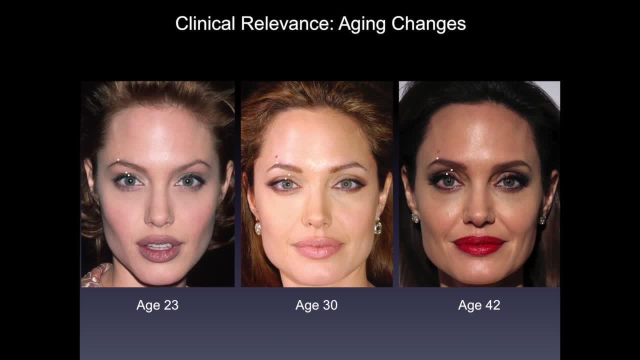 Celebrities With Scleral Show 60 Photos - Moonagedaydream.film